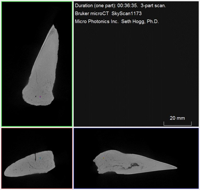 Micro-CT Image of Shark Teeth With the Bruker SkyScan 1173