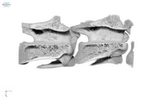 X-ray Microscopic Inspection of Poultry Bones | Micro Photonics