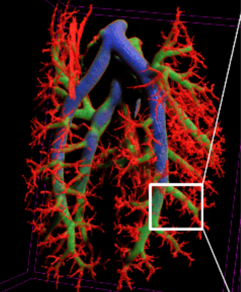 Micro-CT for Soft Tissue (Preclinical) Research | Micro Photonics